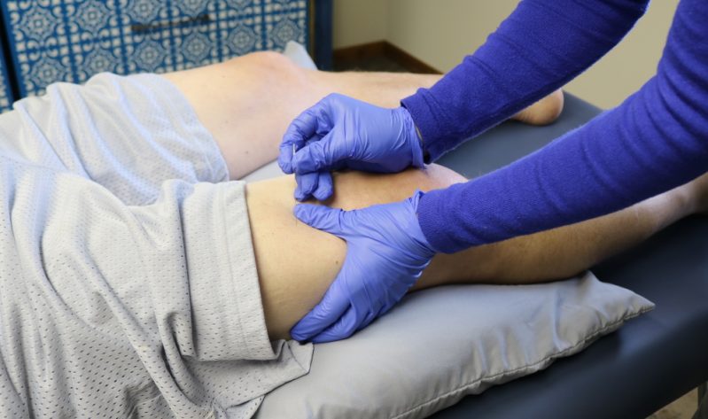 Trigger Point Dry Needling – True North Physical Therapy